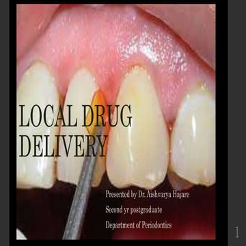 Local drug delivery system | PPTX