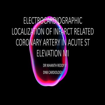 Localization of MI on ECG | PPT