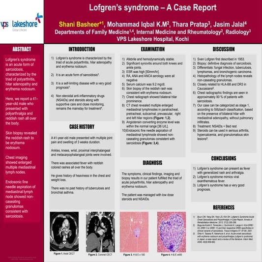 lofgrens-syndrome-a-case-report.pdf | Lung and Respiratory Health ...