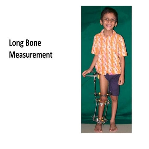 Long bone measurement | PPT