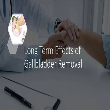 Advantages and Disadvantages of Mini Gastric Bypass Surgery | PPTX