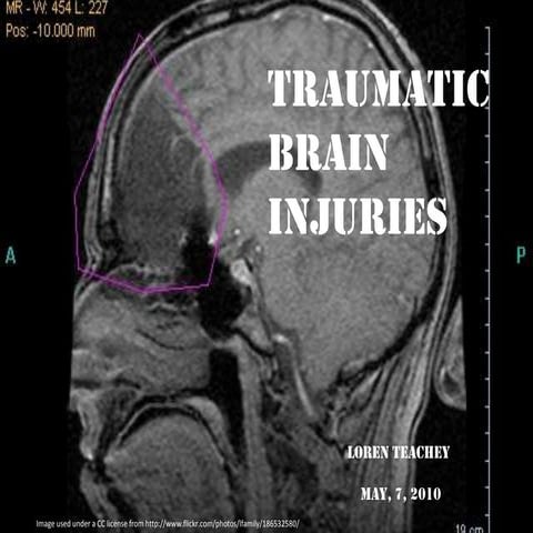 Loren's Veterans' Issues Presentation, 7th period | PPTX | Death ...