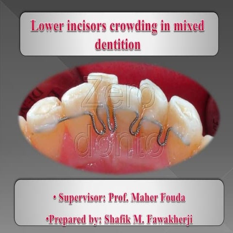 orthodontic arch form | PPTX