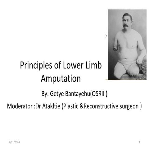 Lower limb Amputation.pptx