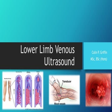 Lower_Limb_Venous_Ultrasound Imaging_2018.pdf
