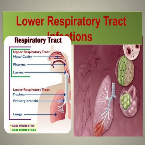 Lower Respiratory Tract infections .pptx