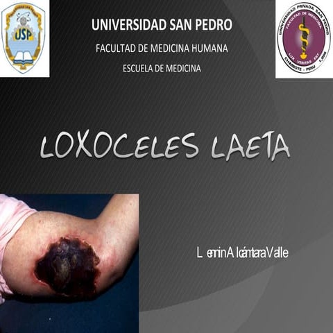 ARACNOIDISMO - LOXOSCELES LAETA | PPTX
