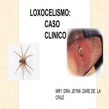 Loxoscelismo | PPTX