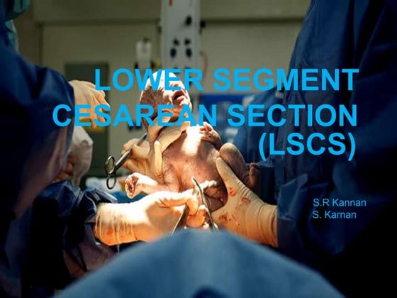 Lower segment ceasarean section(lscs) | PPTX