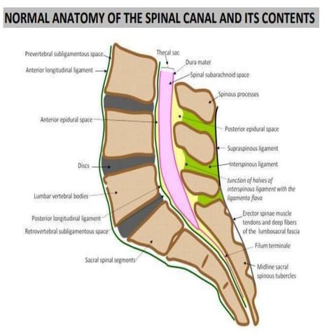 Imaging of lumbar spondylosis | PPTX