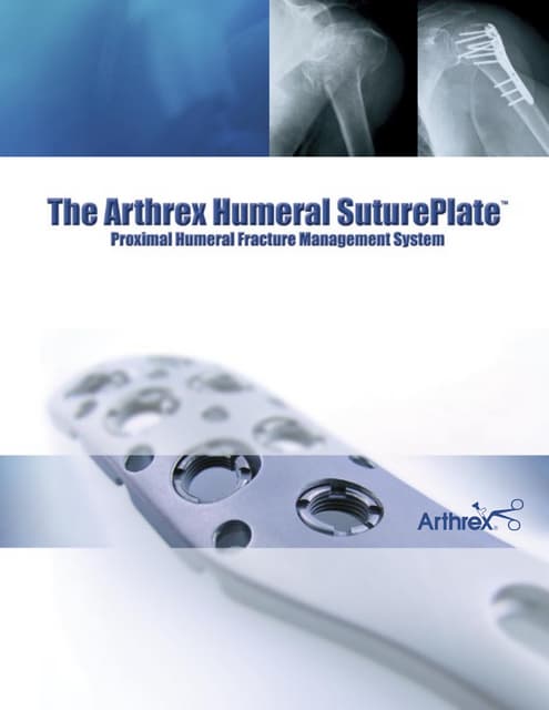 Lt0515 d suturebridge | PDF