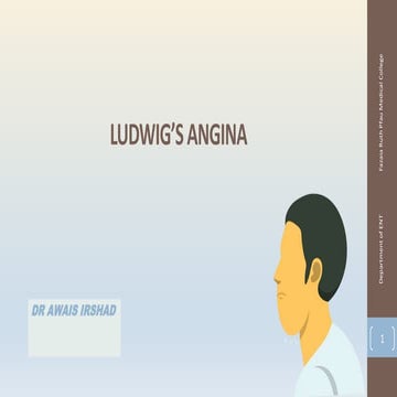 LUDWIGS ANGINA.pptx