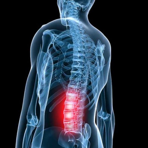 Chronic Spine Pain | PDF