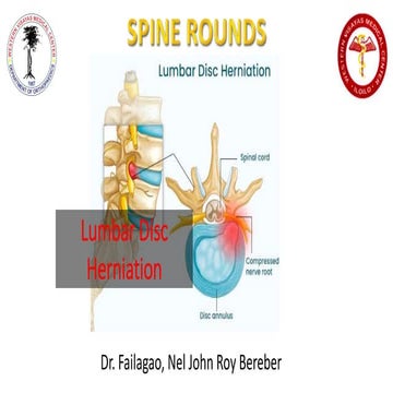 LUMBAR DISC HERNIATION.pptx