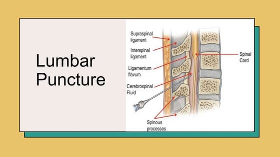 Lumbar Puncture Layers Penetrated A Novel Manipulator With Needle