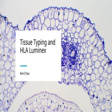 Luminex, Tissue typing and HLA matching. | PPTX