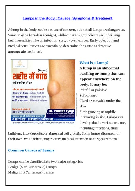 What Is Lipoma Know Its Causes, Symptoms And Treatment.pptx