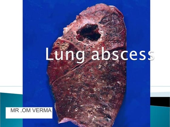 Lungs abscess | PPT