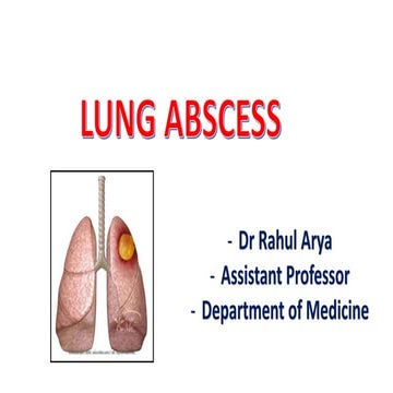 Lung abscess | PPT