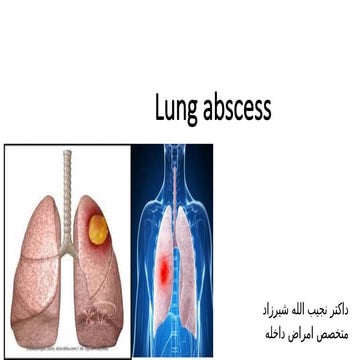 Lung abscess (2).pptx by dr mahmood ibrahimi | PPTX