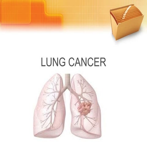 Lung cancer | PPT
