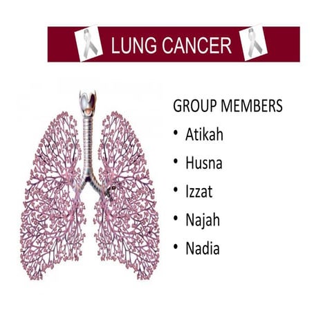 Lung cancer | PPT