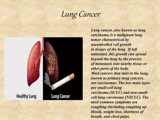 Lung Cancer | PPT