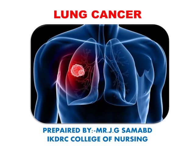 Lung Cancer Ppt