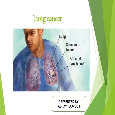 Lung cancer | PPTX