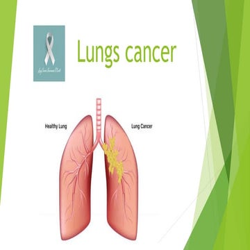 Lung cancer.pptx