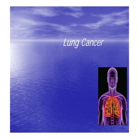 Lung cancer | PPTX