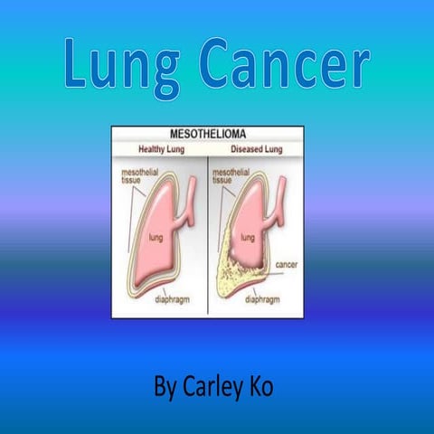 Lung cancers | PPTX