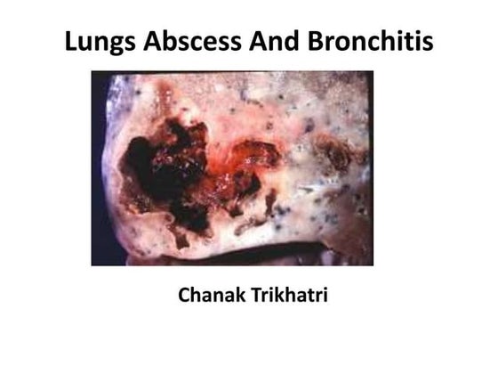 pleural effusion-1.pdf Types, pathophysiology, clinical features ...