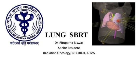 SBRT (Stereotactic Body Radiation Therapy in Lung Cancer.pptx