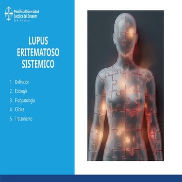 Analisis de Lupus, Neurolupus, SAF a fin de entender sus diferencias | PPTX