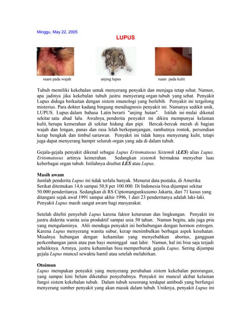Systemic_lupus_erythematosus_sle_materi.pptx
