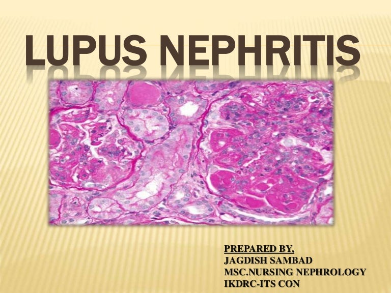 Lupus nephritis