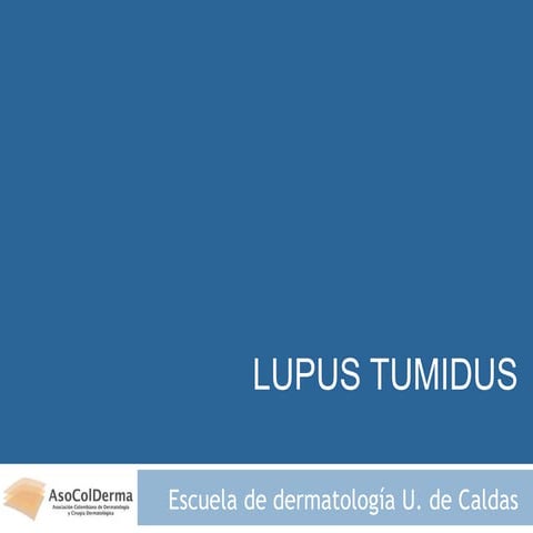 Lupus tumidus | PPTX
