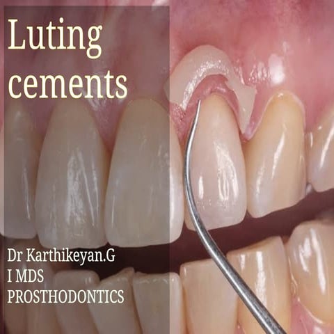 LUTING CEMENTS - A PROSTHODONTIST'S POV | PPTX