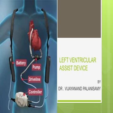 Lvad vijayanand | PPTX