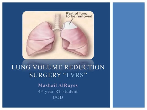 Lung volume reduction surgery (2) | PPT