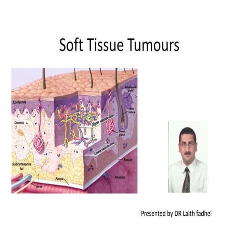 Soft tissue tumours | PPTX