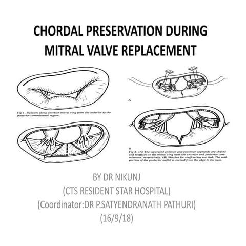 Chordal preservation DR NIKUNJ R SHEKHADA (MBBS,MS GEN SURG ,DNB CTS SR ...