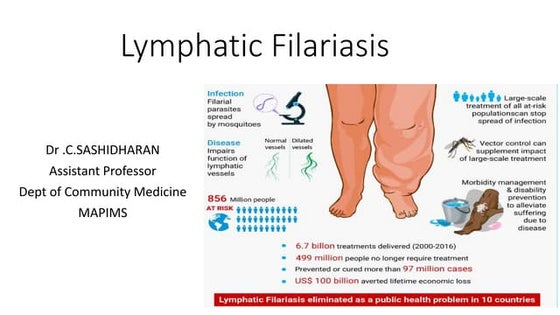 Lymphatic Filariasis Treatment WHO Issues New Treatment Guidelines For