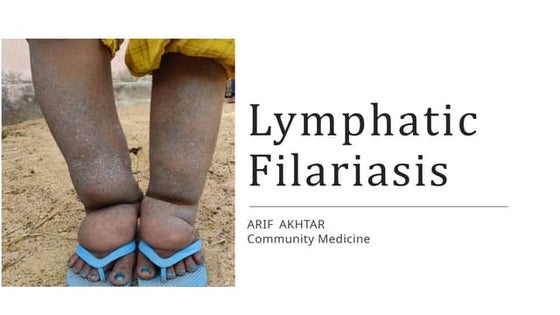 filariasis in Community Health Nursing...1.pptx