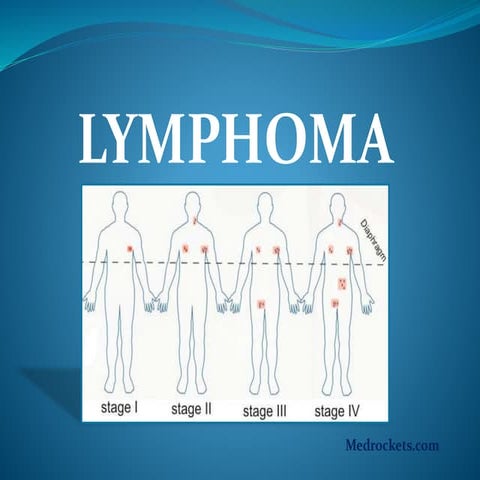 Lymphoma | PPTX