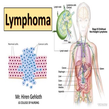 Lymphoma | PPTX