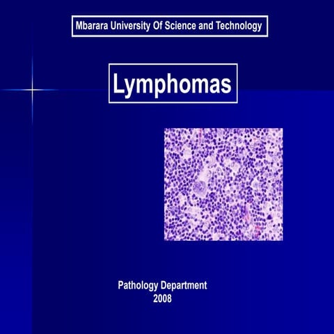 lymphomas(L).ppt