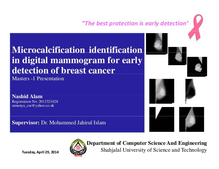 MICROCALCIFICATION IDENTIFICATION IN DIGITAL MAMMOGRAM FOR EARLY DETE…