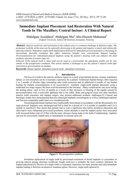 Periodontology 2000 - 2023 - Yu - Simultaneous or staged lateral ridge ...